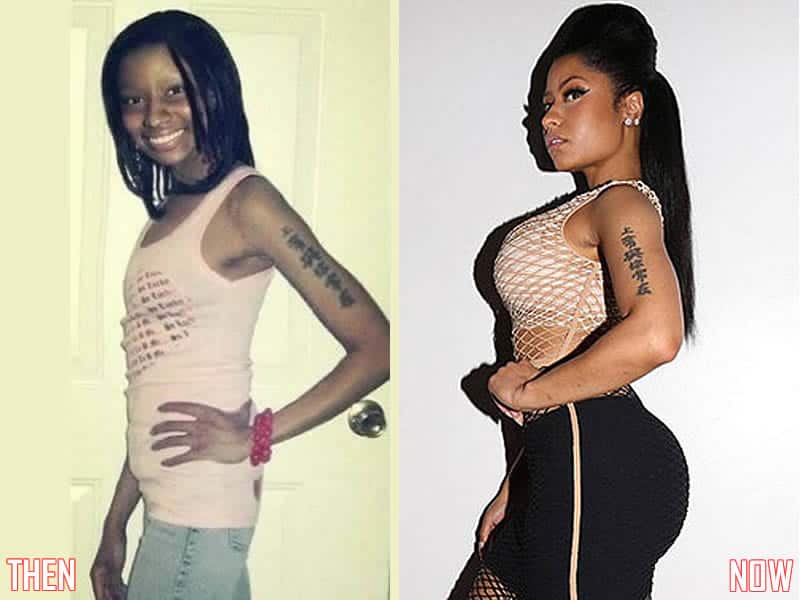 Did Nicki Minaj Get Breast & Butt Implants? Did Nicki Minaj Get Breast & Butt Implants?