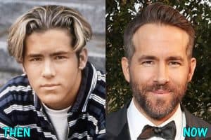 Ryan Reynolds Plastic Surgery - Hair Transplant, Teeth Fix, Nose Job?