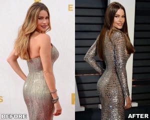 Has Sofia Vergara Had Plastic Surgery (Before & After 2021)