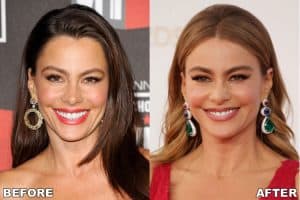 Has Sofia Vergara Had Plastic Surgery (Before & After 2021)