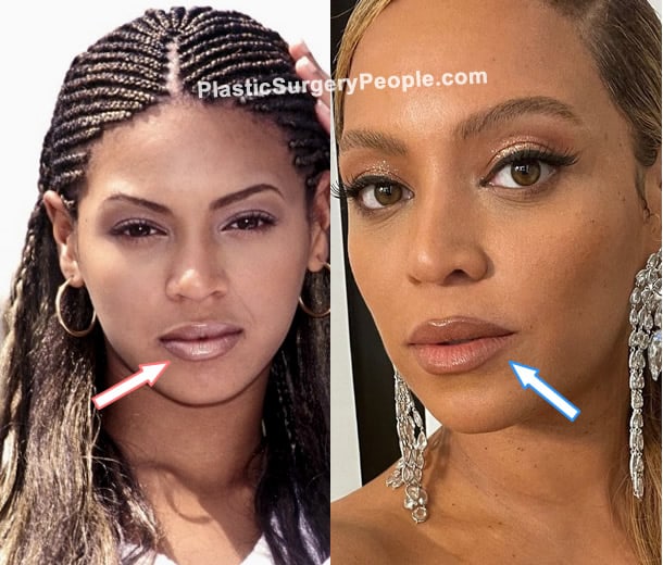 Beyonce: BEFORE and AFTER 2022