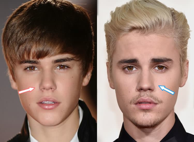 Justin Bieber, Before and After Transformation 2018!