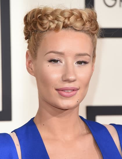 Iggy Azalea Plastic Surgery EXPLAINED! (Before & After 2018) Iggy Azalea Plastic Surgery EXPLAINED! (Before & After 2018)