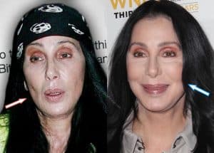 Cher: Before and After 2020