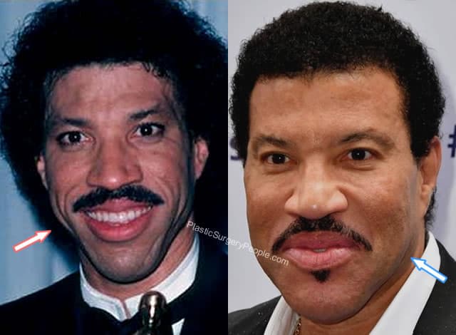 Lionel Richie: BEFORE and AFTER 2022