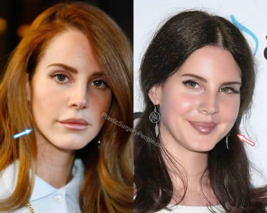 Lana Del Rey: BEFORE and AFTER 2019