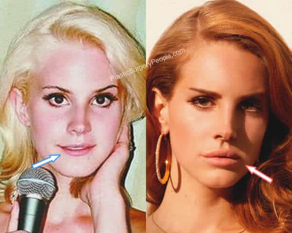 Lana Del Rey: BEFORE and AFTER 2019