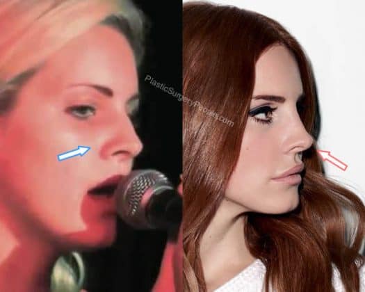 Lana Del Rey: BEFORE and AFTER 2019