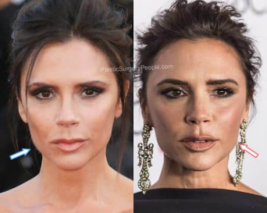 Victoria Beckham, BEFORE and AFTER 2022