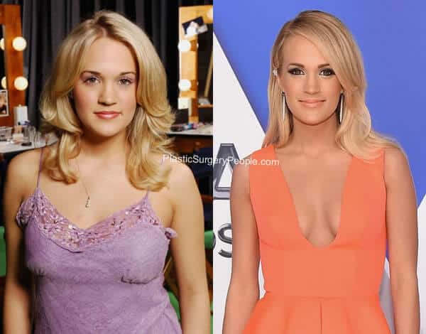 Carrie Underwood: BEFORE and AFTER Carrie Underwood: BEFORE and AFTER