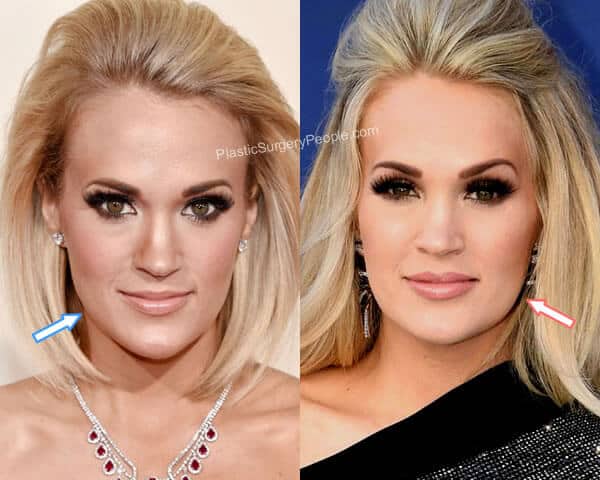 Carrie Underwood: BEFORE and AFTER Carrie Underwood: BEFORE and AFTER