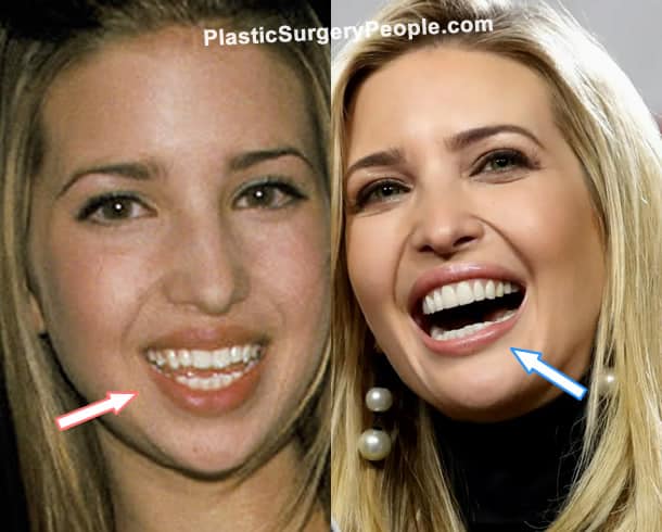 Ivanka Trump: BEFORE and AFTER 2022