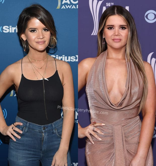 Maren Morris, BEFORE and AFTER 2022