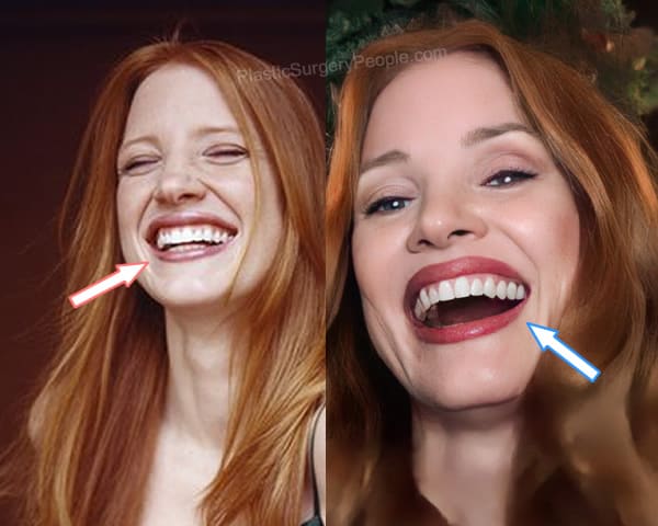 Jessica Chastain, BEFORE and AFTER 2022