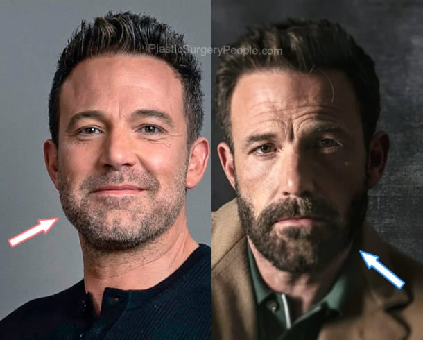 Ben Affleck: BEFORE and AFTER 2022