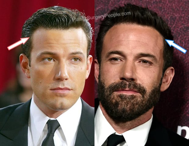 Ben Affleck: BEFORE and AFTER 2022
