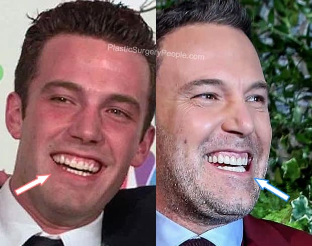 Ben Affleck: BEFORE and AFTER 2022